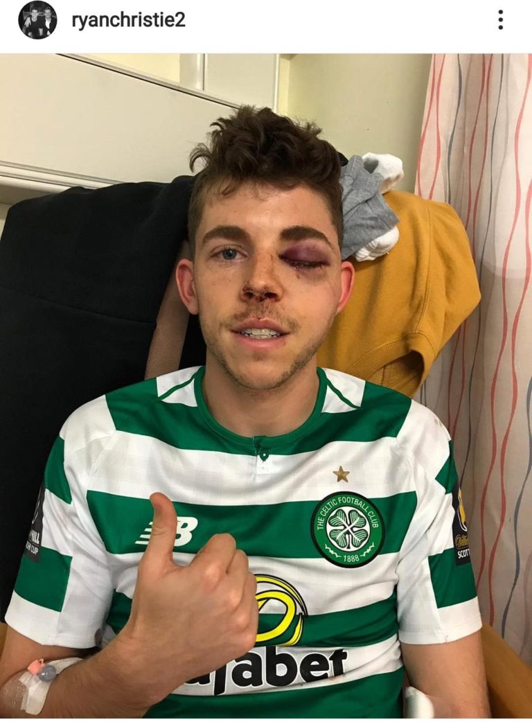 Albert Kidd? ‘I would like to have kicked his head in,’ Sandy Clark on ...