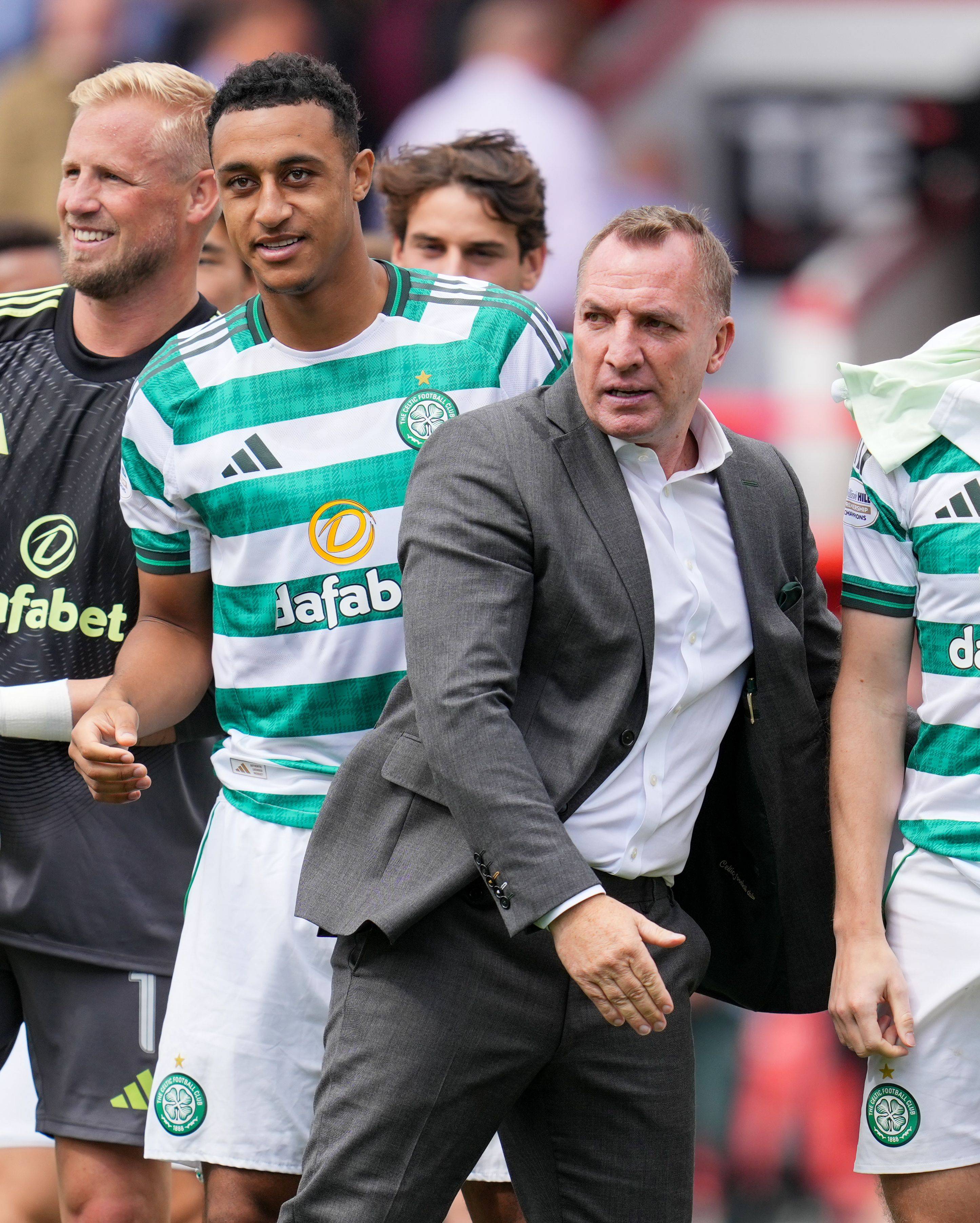 Tieless conspiracy theory jovially dismissed by Celtic manager